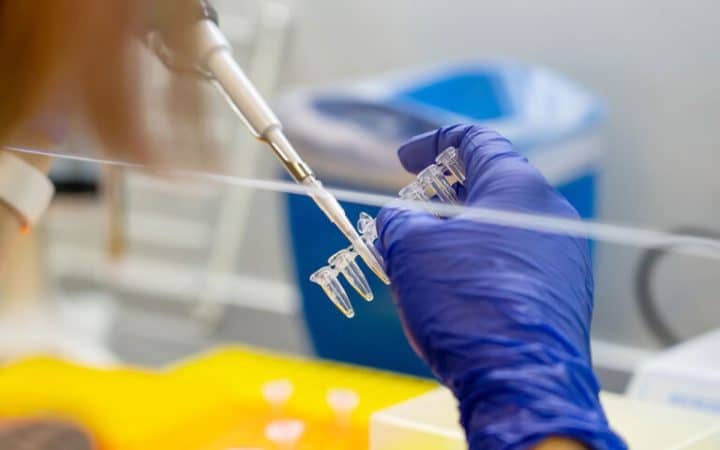 18 нови случаи на мајмунски сипаници во Грција - Радио Лидер